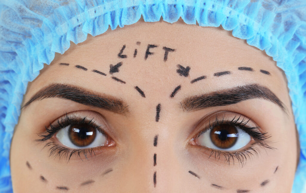 Endoscopic Brow Lift | Ophthalmology & Visual Sciences