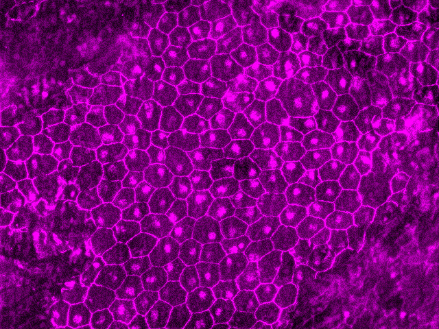 Science in Focus: Art Beyond the Microscope | Ophthalmology & Visual ...