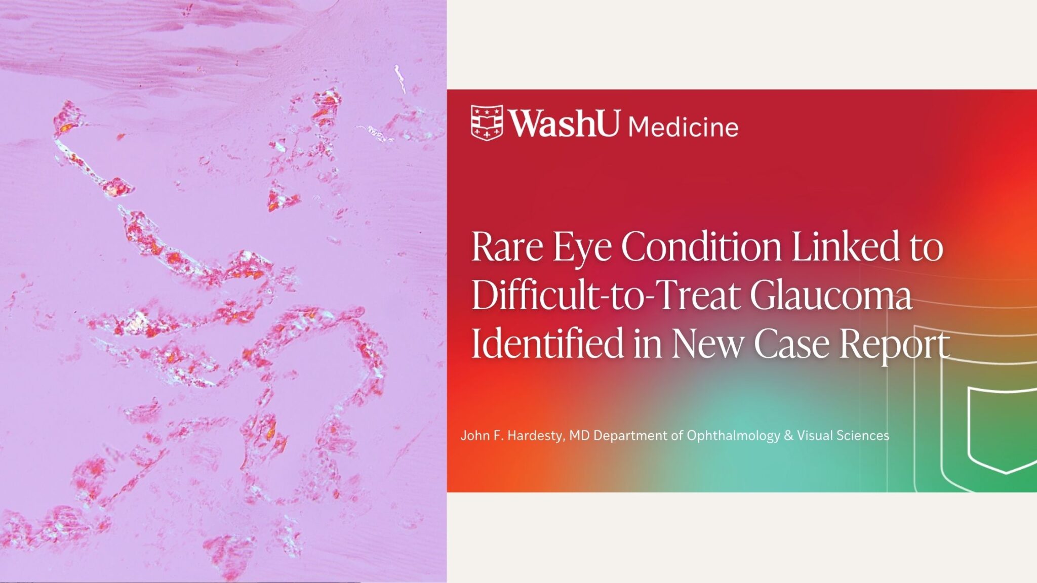 Ophthalmology & Visual Sciences | Washington University in St. Louis