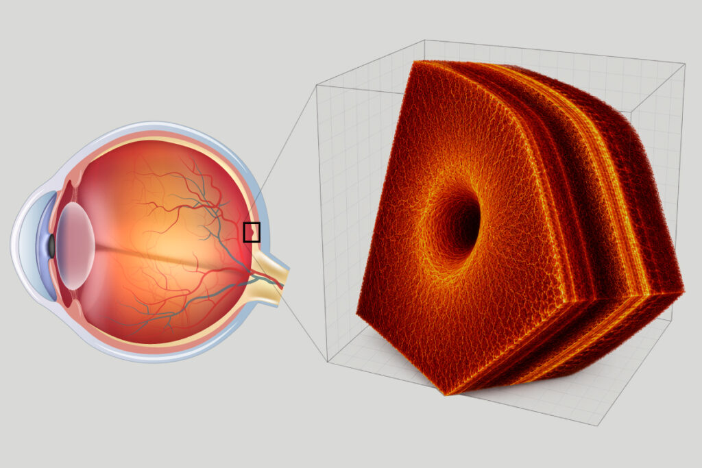 New AI tools could help eye doctors diagnose retinal disease faster ...