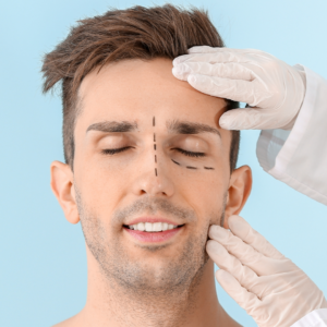 Eyelid Surgery Experts | WashU Medicine Oculofacial Plastic Surgeons